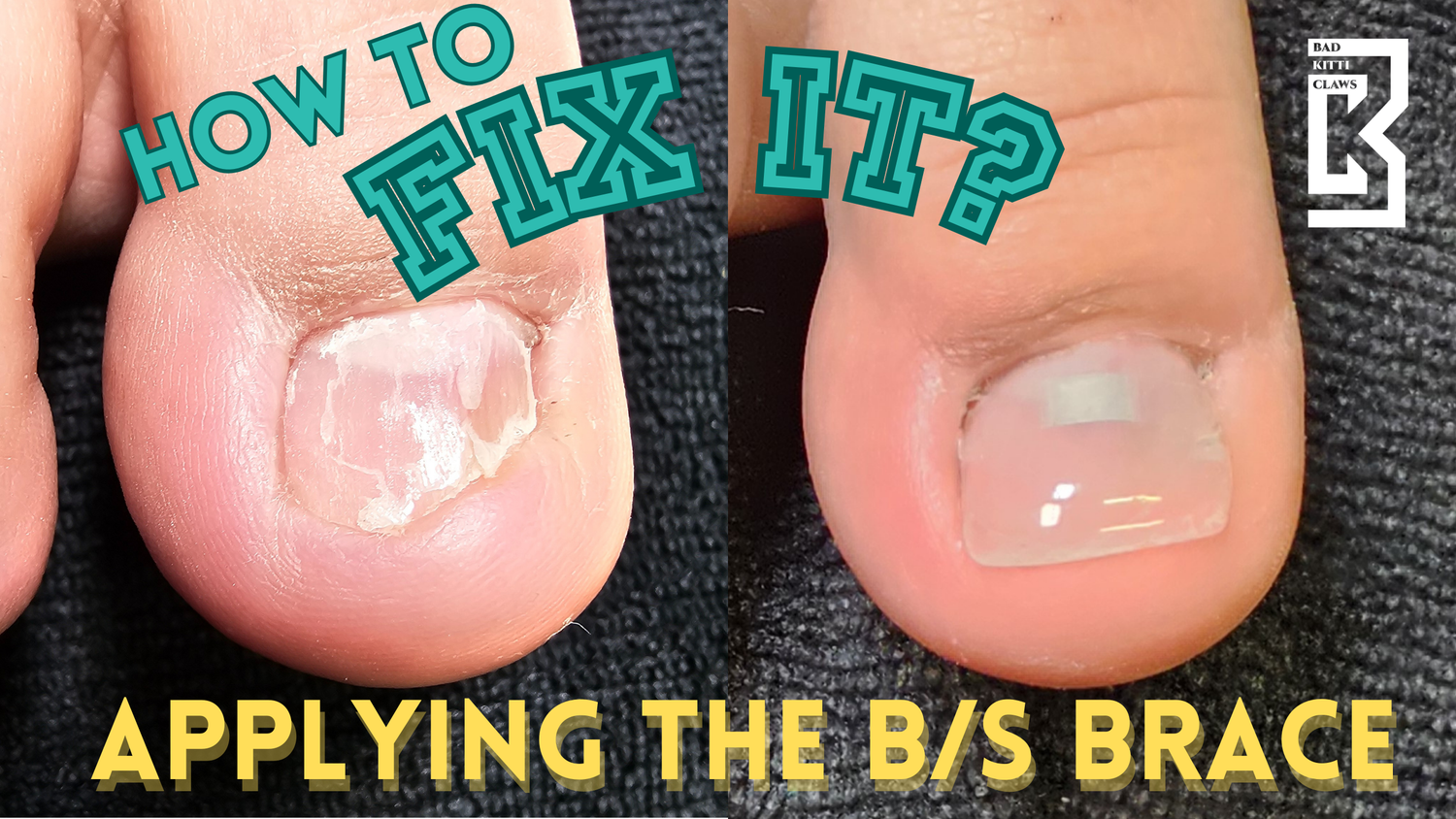B/S Brace | Healthy Nails by Bad Kitti Claws