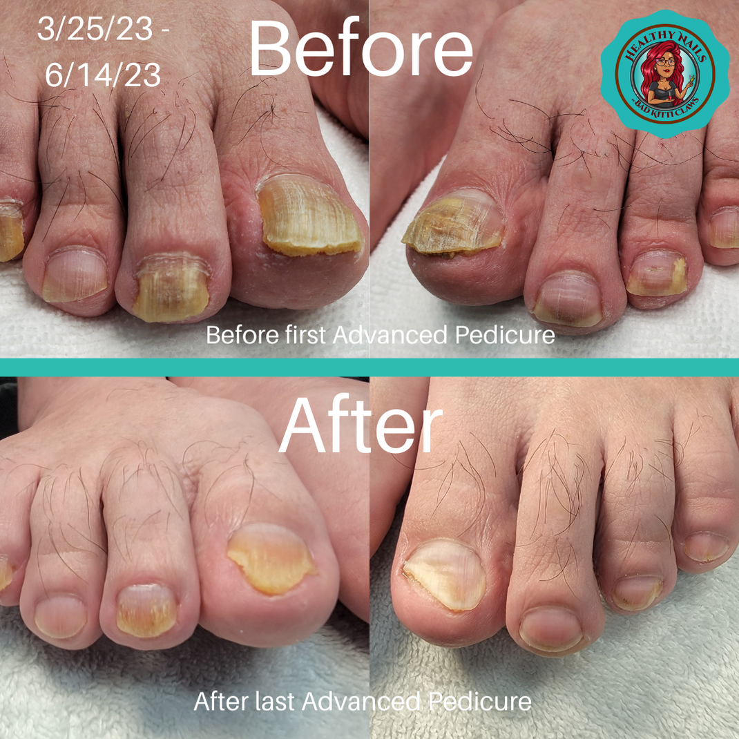 Advanced Pedicures – Bad Kitti Claws