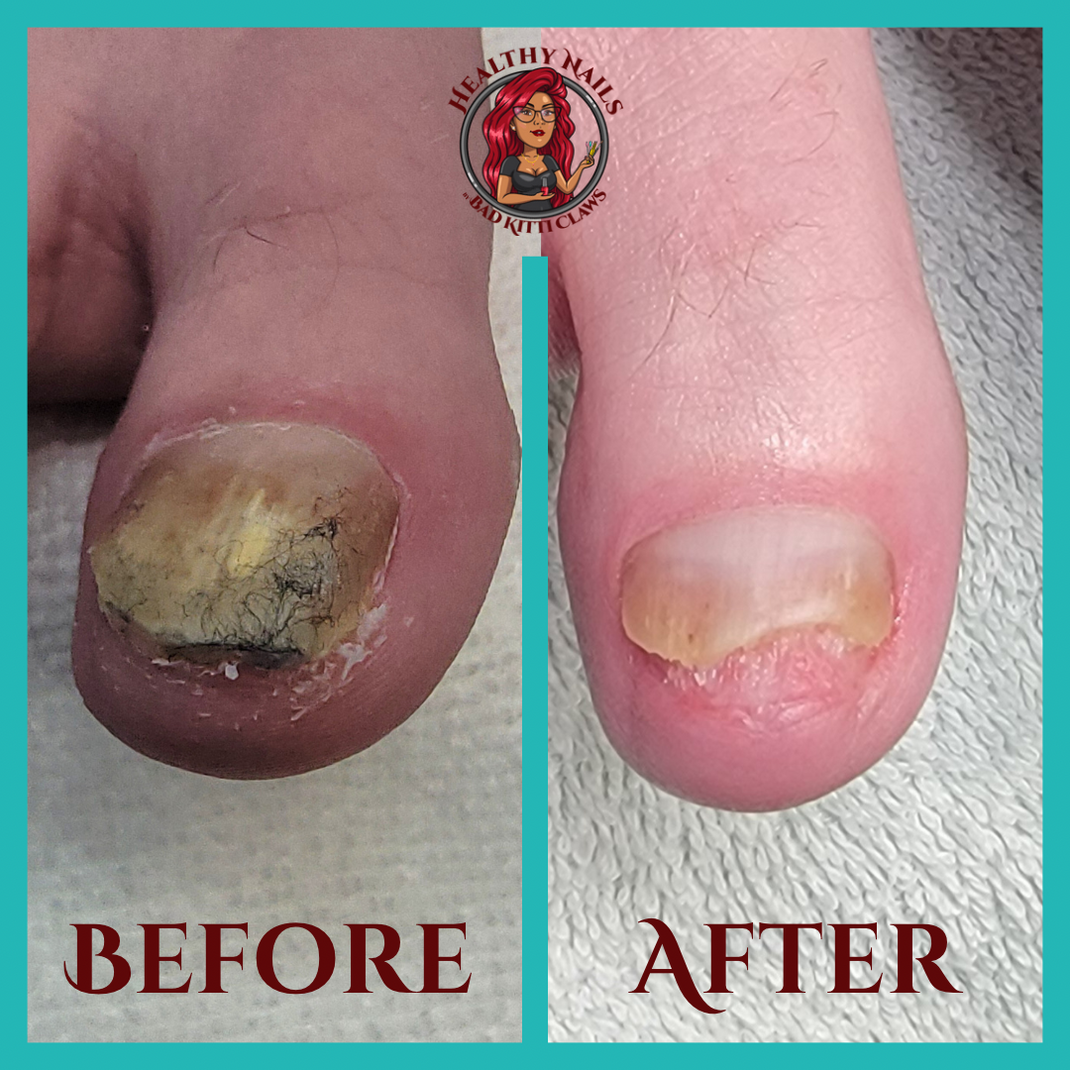 Advanced Pedicures – Bad Kitti Claws